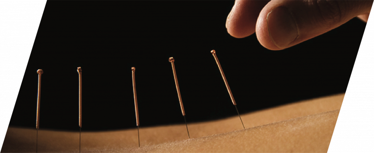 Acupuncture Blanket - Heatsheets